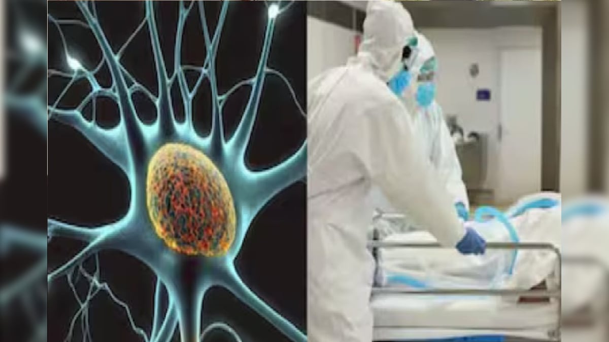 GBS Outbreak : पुणे, कोल्हापूरनंतर आता सांगलीत जीबीएसचा शिरकाव, 'इतक्या ...