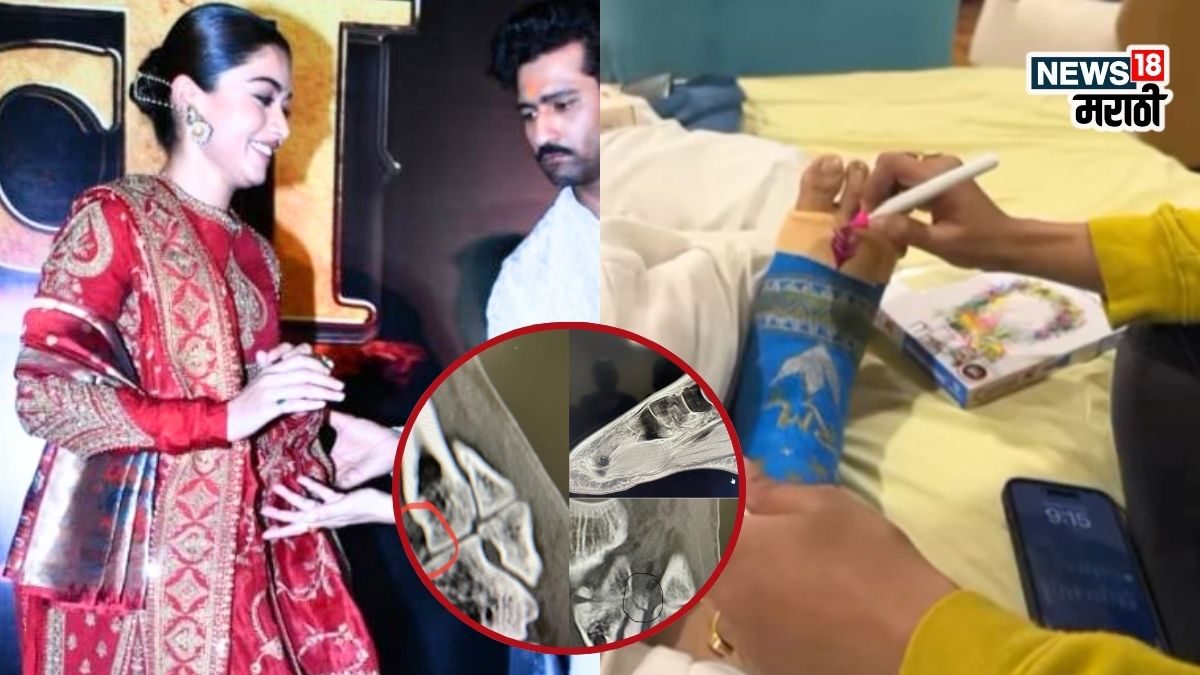 Rashmika Mandana : 'छावा'च्या ट्रेलरला लंगडत आली रश्मिका, पायाला झालंय ...