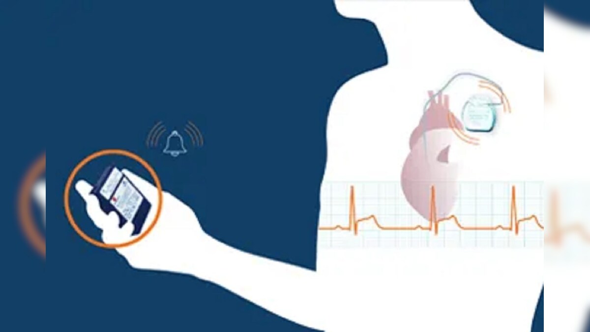Heart Attack येण्यापूर्वीच मिळेल अलर्ट! पण हे काम कसे करते? घ्या जाणून ...