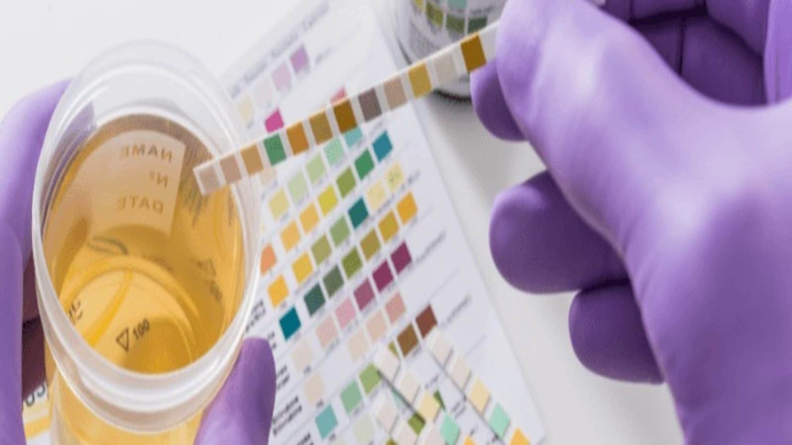 Urine color indicate multiple things about your health Urine Color ...