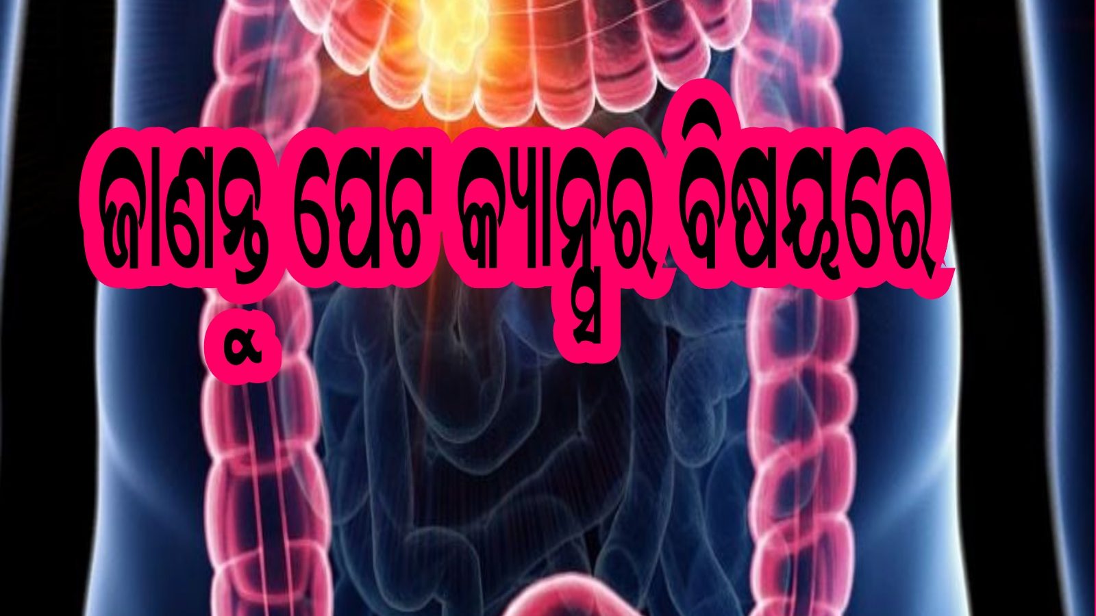 Colon Cancer: ଆଜି ହି ଖାଇବା ବନ୍ଦ କରନ୍ତୁ ଏହି ଖାଦ୍ୟ; ନଚେତ୍ ହେବ ପେଟ ...