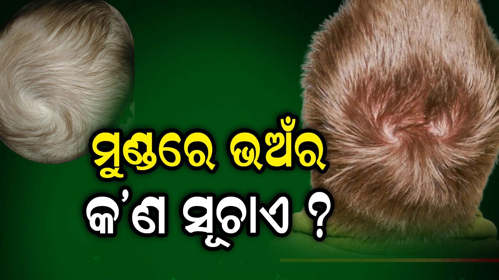 whirls-in-head-what-is-the