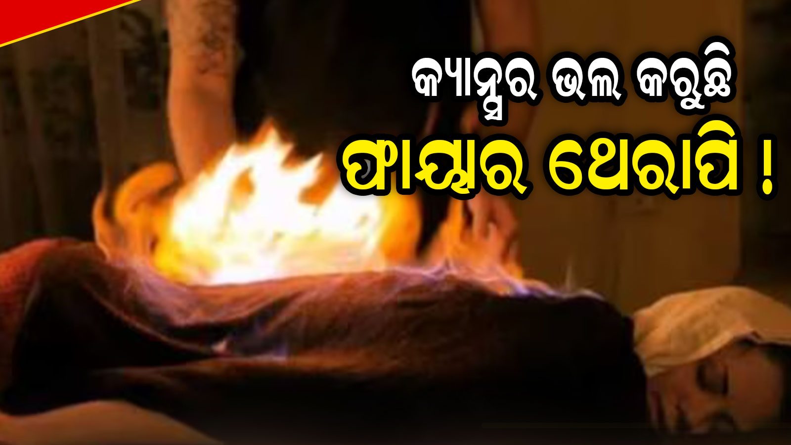 Fire Therapy: କ୍ୟାନ୍ସର ଭଳି ରୋଗକୁ ଭଲ କରି ଦେଉଛି ଫାୟାର ଥେରାପି... Fire ...