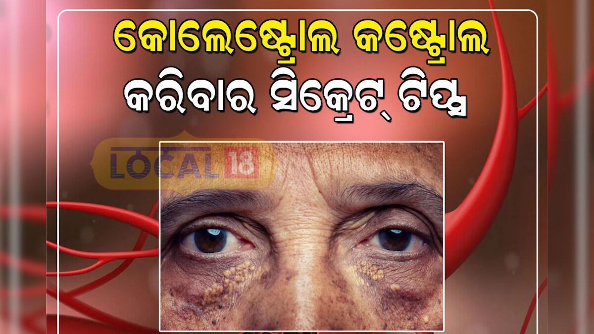 Cholesterol Control Tips: ବଢ଼ୁଥିବା କୋଲେଷ୍ଟ୍ରଲକୁ ନେଇ ଚିନ୍ତିତ, କରନ୍ତୁ ...