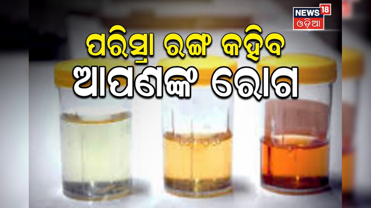 Urine Symptoms: ପରିସ୍ରାର ଭିନ୍ନ ଭିନ୍ନ ରଙ୍ଗ କହିବ ଆପଣଙ୍କ ରୋଗ, ଏହି ସଙ୍କେତ ...