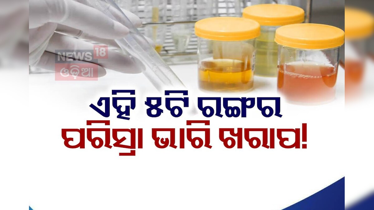 Urine Problem: ପରିସ୍ରାର ରଙ୍ଗ ବଦଳିବା ଭାରି ଖରାପ, ୫ଟି କଲର କହିବ ଆପଣଙ୍କ ରୋଗ ...