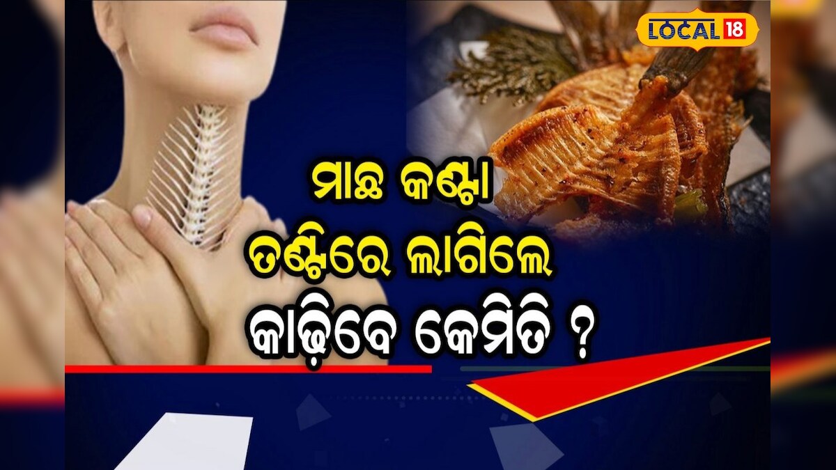 Fish Bone Stuck in Throat:ଗଳାରେ ମାଛ କଣ୍ଟା ଲାଗିଯାଇଛି ? ଜାଣନ୍ତୁ କାଢ଼ିବାର ...