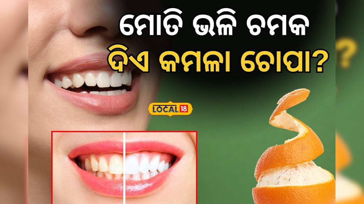 Teeth Whitening: ଦାନ୍ତର ହଳଦିଆପଣ ଦୂର କରେ କି କମଳା ଚୋପା? ଡେଣ୍ଟିଷ୍ଟ କରିଦେଲେ ...