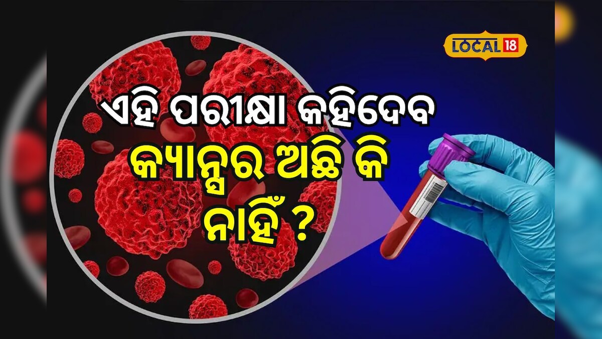 How to Detect Cancer:କରନ୍ତୁ ଗୋଟିଏ ପରୀକ୍ଷା ଜଣାପଡ଼ିବ ଶରୀରରେ କର୍କଟ ରୋଗ ଅଛି ...