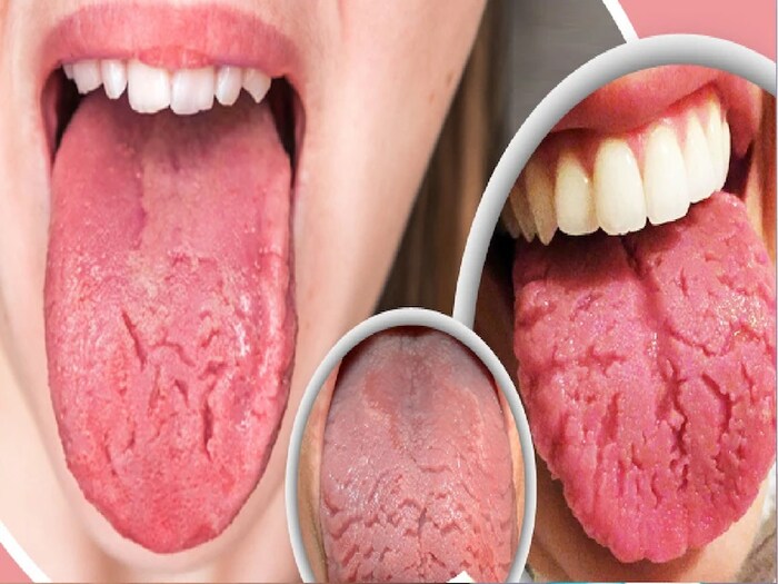Oral Cancer: ଏଗୁଡ଼ିକ ହେଉଛି ମୁଖ କର୍କଟ ରୋଗର ୫ଟି ପ୍ରାରମ୍ଭିକ ଲକ୍ଷଣ ...