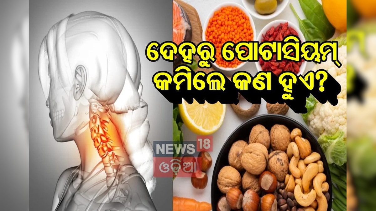 Potassium Deficiency: ପୋଟାସିୟମ୍ ଶରୀରରୁ କମିଲେ କଣ ହୁଏ? ଜାଣନ୍ତୁ ଡାକ୍ତରଙ୍କ ...