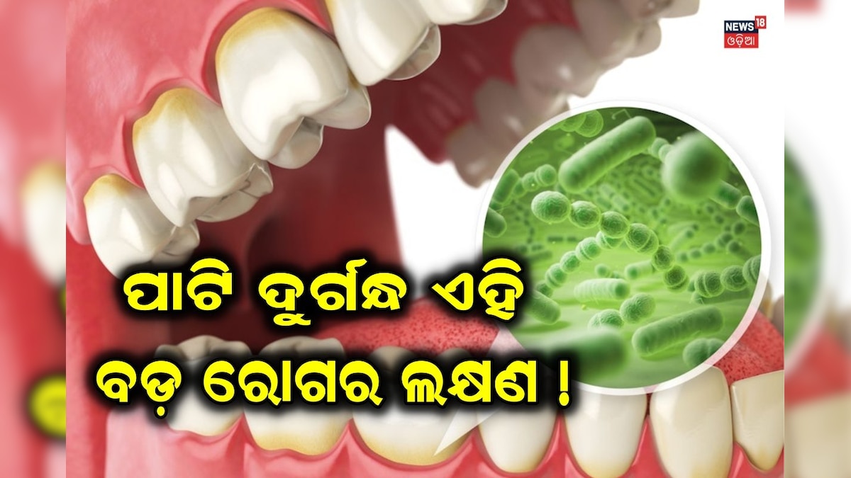 ପାଟି ଦୁର୍ଗନ୍ଧ ହେଉଥିଲେ ସାବଧାନ! ଏହି ବଡ଼ ରୋଗର ଲକ୍ଷଣ ହେଉଛି Bad Breath bad ...