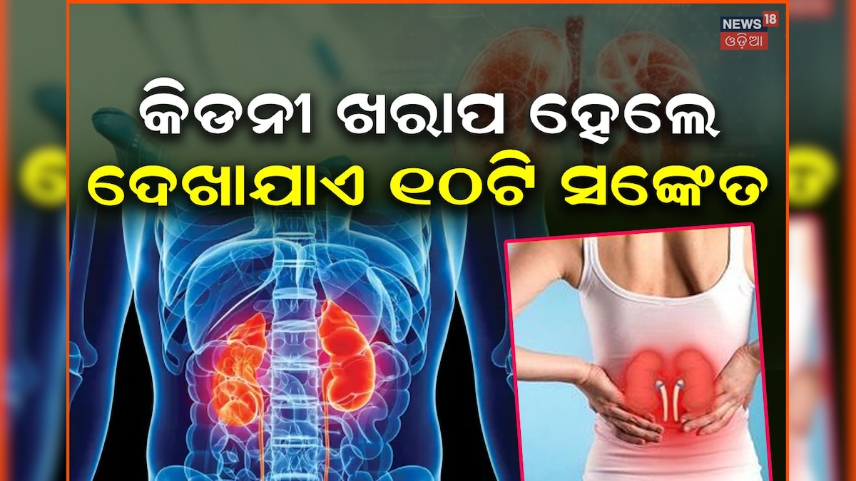 Kidney Damage Symptoms: ଯଦି ଦେଖୁଛନ୍ତି ଏହି ୧୦ଟି ଲକ୍ଷଣ, ସାବଧାନ! କିଡନୀ ...