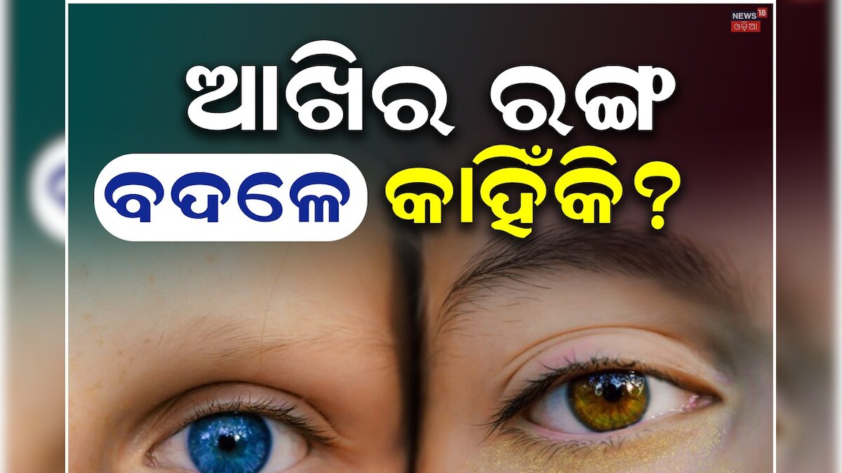 କାହିଁକି ହୋଇଥାଏ ଆଖିର ରଙ୍ଗ ପରିବର୍ତ୍ତନ? ଜାଣନ୍ତୁ ଏହା ପଛର କାରଣ..., Why does ...