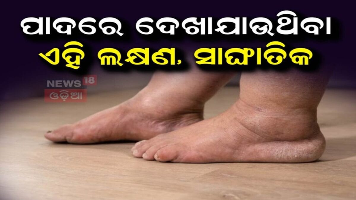 Swollen Feet Reason: ପାଦ କହିବ ଆପଣଙ୍କ ରୋଗ! ଲକ୍ଷଣକୁ କରନ୍ତୁନି ଅଣଦେଖା, କାରଣ ...