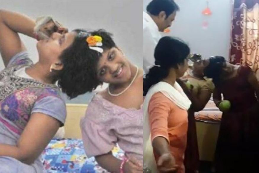 ਸਿਰ ਤੋਂ ਜੁੜਵਾਂ ਵੀਨਾ-ਵਾਣੀ 10ਵੀਂ ਦੀ ਪ੍ਰੀਖਿਆ ਦੇਣ ਲਈ ਆਗਿਆ ਦੀ ਉਡੀਕ 'ਚ ...