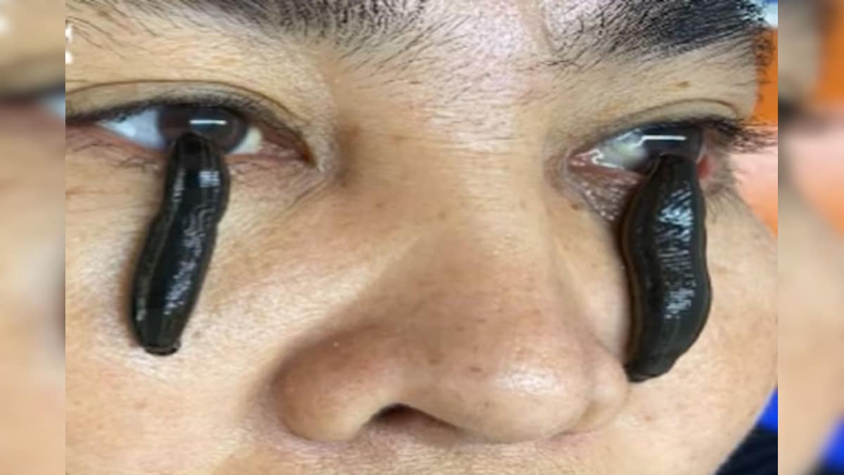 ਨਿਗ੍ਹਾ ਤੇਜ਼ ਕਰਨ ਦਾ ਇਹ ਅਨੋਖਾ ਤਰੀਕਾ!, ਅੱਖਾਂ ਦੀਆਂ ਪੁਤਲੀਆਂ ਉਤੇ ਛੱਡੇ ਜਾਂਦੇ ...