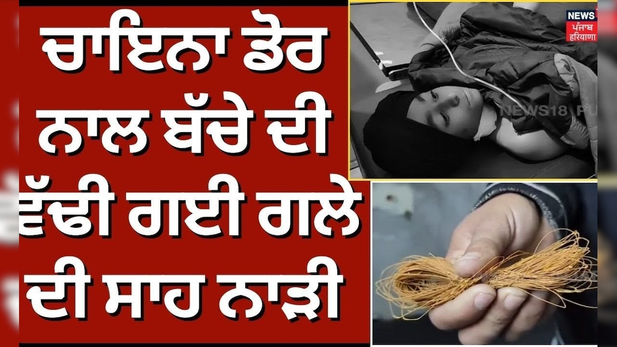 Abohar News | China Dor ਨਾਲ ਬੱਚੇ ਦੀ ਵੱਢੀ ਗਈ ਗਲੇ ਦੀ ਸਾਹ ਨਾੜੀ | Punjab ...