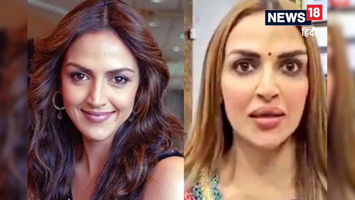 Esha Deol ਨੇ ਕਾਰਵਾਈ Lip ਸਰਜਰੀ! ਉਸ ਸਮੇਂ ਦੀਆਂ ਅਤੇ ਹੁਣ ਦੀਆਂ ਤਸਵੀਰਾਂ ਹੋਈਆਂ ...