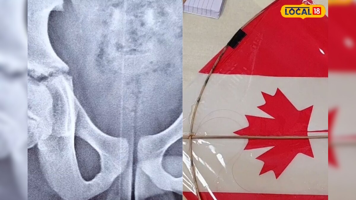 child falls from roof while flying kite suffers serious injuries ...