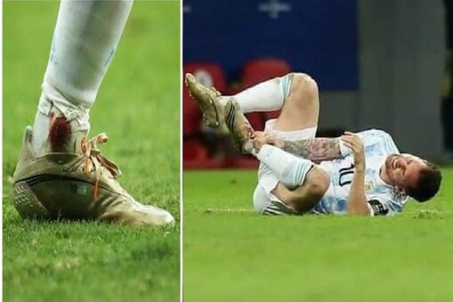Lionel Messi plays with bleeding ankle against Colombia in Copa America ...