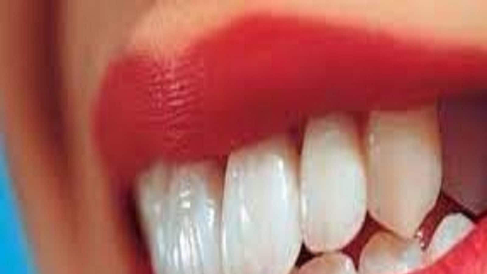 Brushing Teeth, Not Brushing Teeth, Cavity, Smell In Mouth, Dental ...