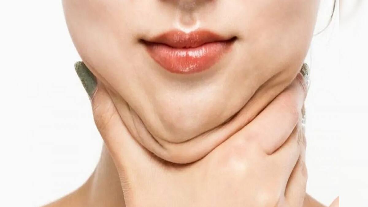 ডাবল চিনের সমস্যা ? মুখের এই ব্যয়ামেই ফিরবে সৌন্দর্য