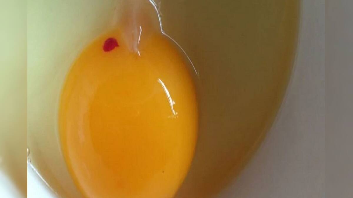 কুসুমে রক্তের দাগ খেয়াল করেছেন কখনও? এমন ডিম খেলে কী হয় জানুন ...