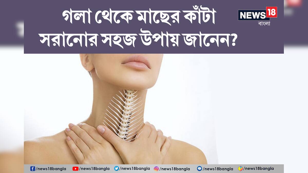 Fish Bone Stuck in Throat: গলায় মাছের কাঁটা বিঁধে অসহ্য যন্ত্রণা! সহজে ...