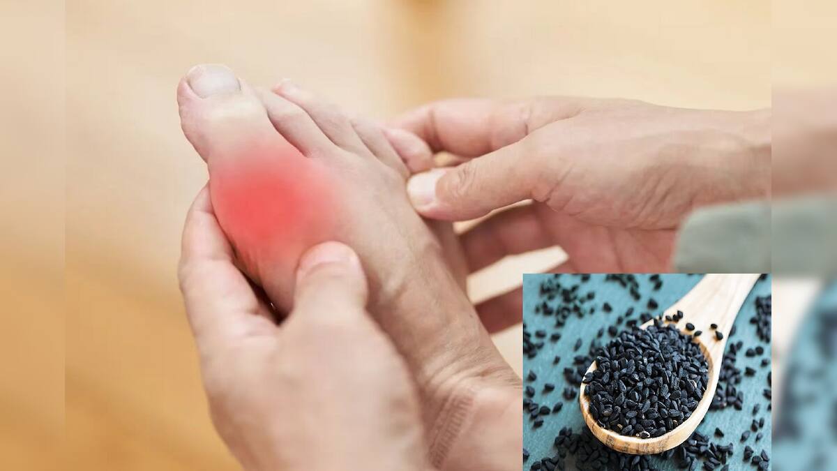 Uric acid। uric acid control tips। some tips to control uric acid ...