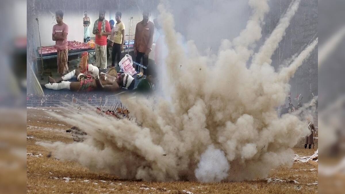 Controversy over admitting Alam Sheikh who injured in bomb blast in ...