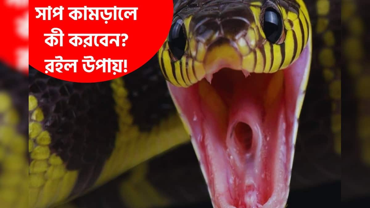 Snake Bite: সাপের কামড়? একদম ভয় পাবেন না! এই ভাবে বাঁচাতে পারেন নিজের ...