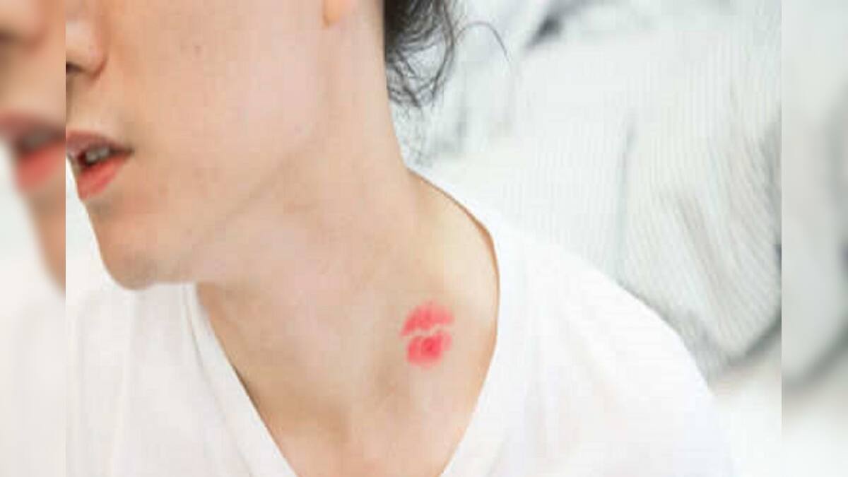 Love Bite Hickey শরীরে 'লভ বাইট' জীবনের জন্য চরম ক্ষতিকরও হতে পারে ...