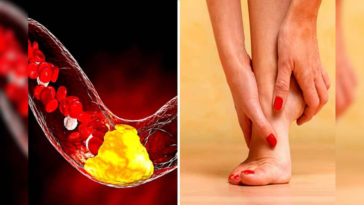 High Cholesterol Sign: পায়ে দেখা দেয় হাই কোলেস্টেরলের উপসর্গ...! কী ...