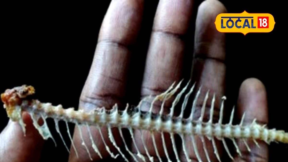 Fish Bone Stuck In Throat: গলায় মাছের কাঁটা আটকালে ভাতের দলা খান ...
