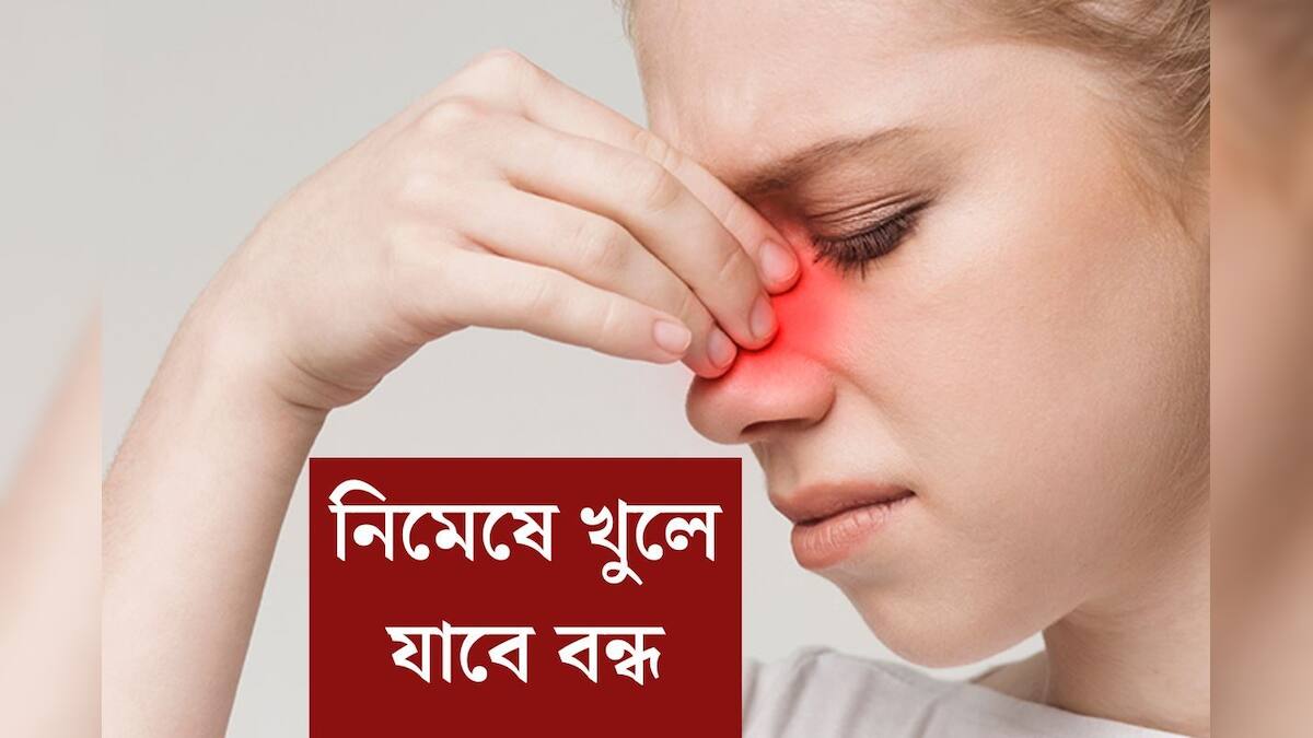 Stuffy Nose: নিমেষে খুলে যাবে বন্ধ নাক! যন্ত্রণাদায়ক এই সমস‍্যা থেকে ...