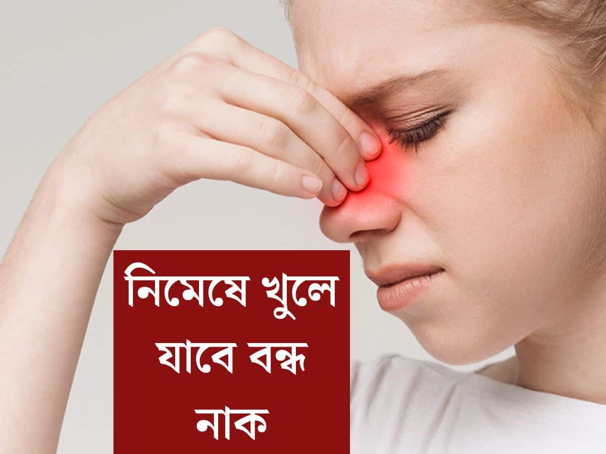 Stuffy Nose: নিমেষে খুলে যাবে বন্ধ নাক! যন্ত্রণাদায়ক এই সমস‍্যা থেকে ...