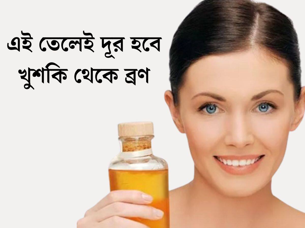 Castor Oil: শুষ্ক ত্বক, ব্রণ বা চুলের খুশকি! এক তেলেই দূর সব সমস‍্যা ...