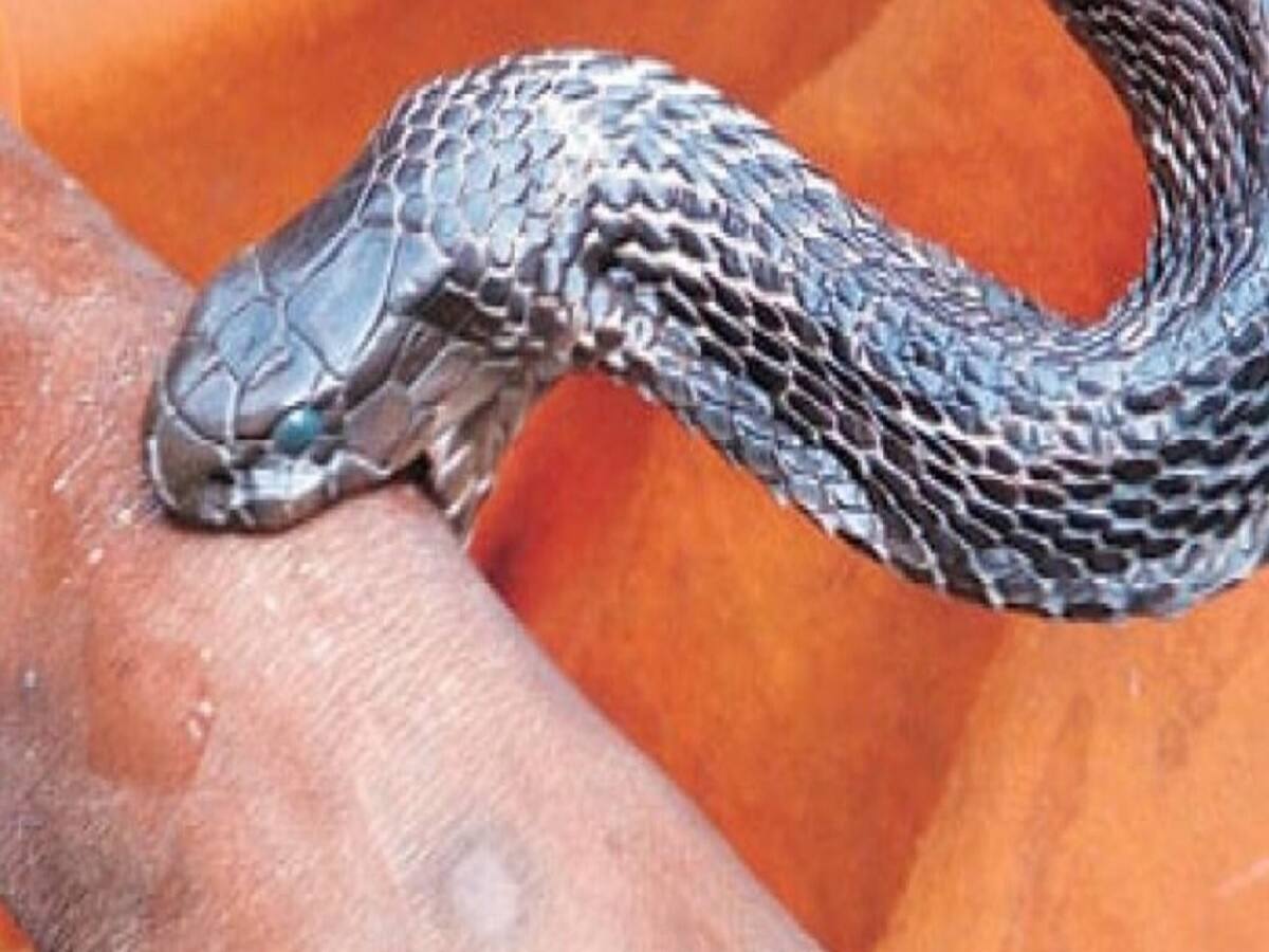 Snake Bite First Aid গরম পড়লেই বাড়বে সাপের উপদ্রব, সাপে কামড়ালে ...