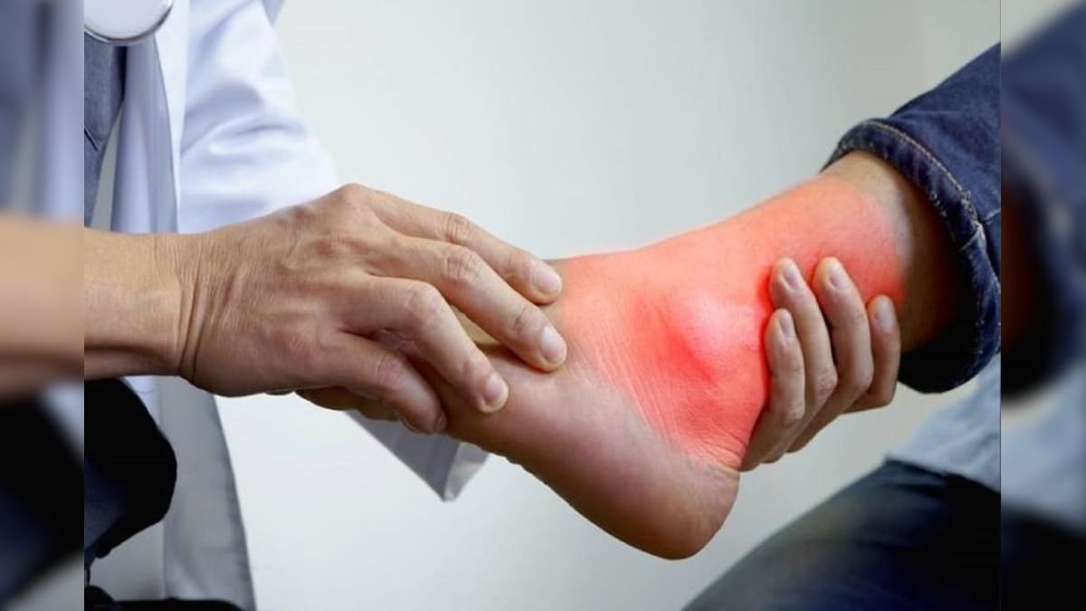Uric Acid Healthcare Tips ইউরিক অ্যাসিড থেকে ক্ষতি হতে পারে কিডনির শুরুতেই সাবধান হন এই ৬টি