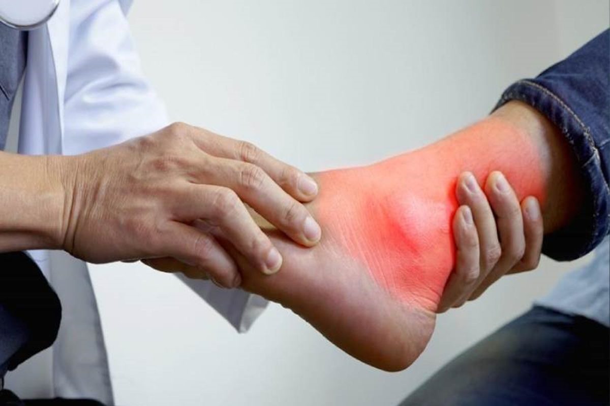 Uric Acid Healthcare Tips ইউরিক অ্যাসিড থেকে ক্ষতি হতে পারে কিডনির শুরুতেই সাবধান হন এই ৬টি