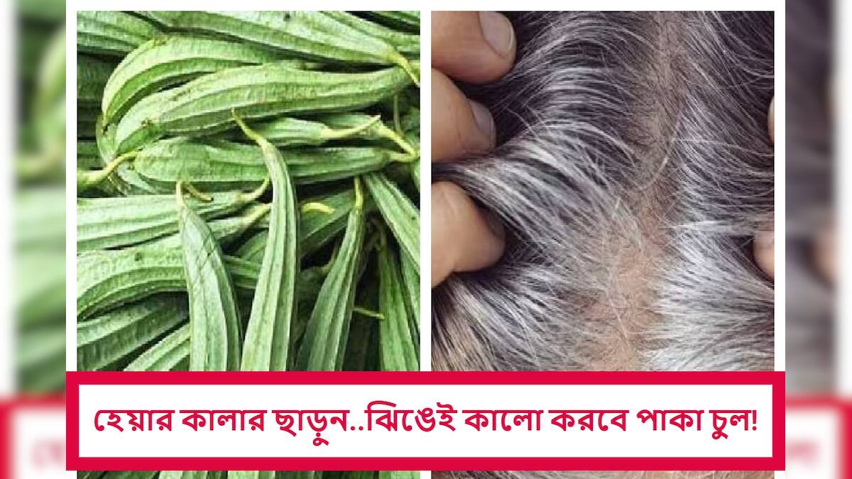 grey hair, Grey Hair Problem: ঝিঙের এই সামান্য টোটকা...তাতেই পাকা চুল ...