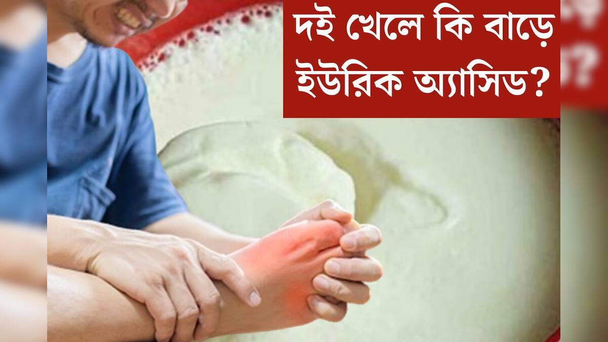 Curd in Uric Acid: গরমে রোজ দই খাচ্ছেন? তলে তলে বাড়ছে না তো ইউরিক অ ...