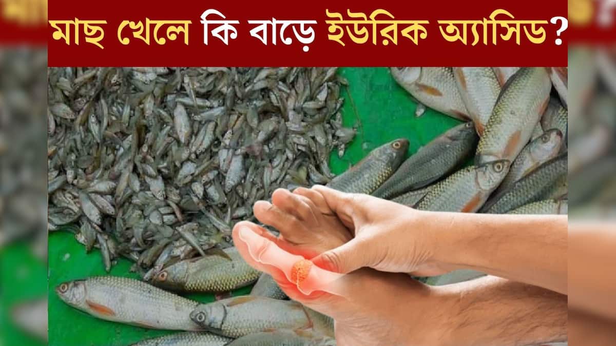Fish in Uric Acid: বর্ষায় দেদার খাচ্ছেন ইলিশ, চিংড়ি! ইউরিক অ‍্যাসিড ...