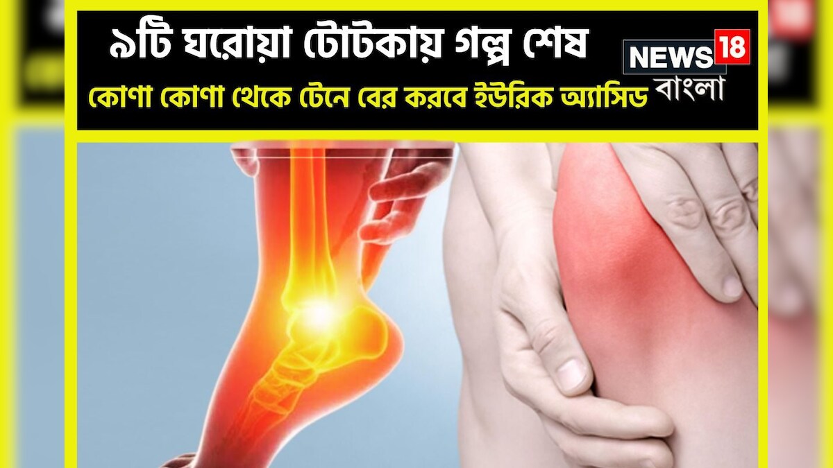 High Uric Acid Control Tips শরীরের কোণা কোণা থেকে টেনে বের করবে ইউরিক