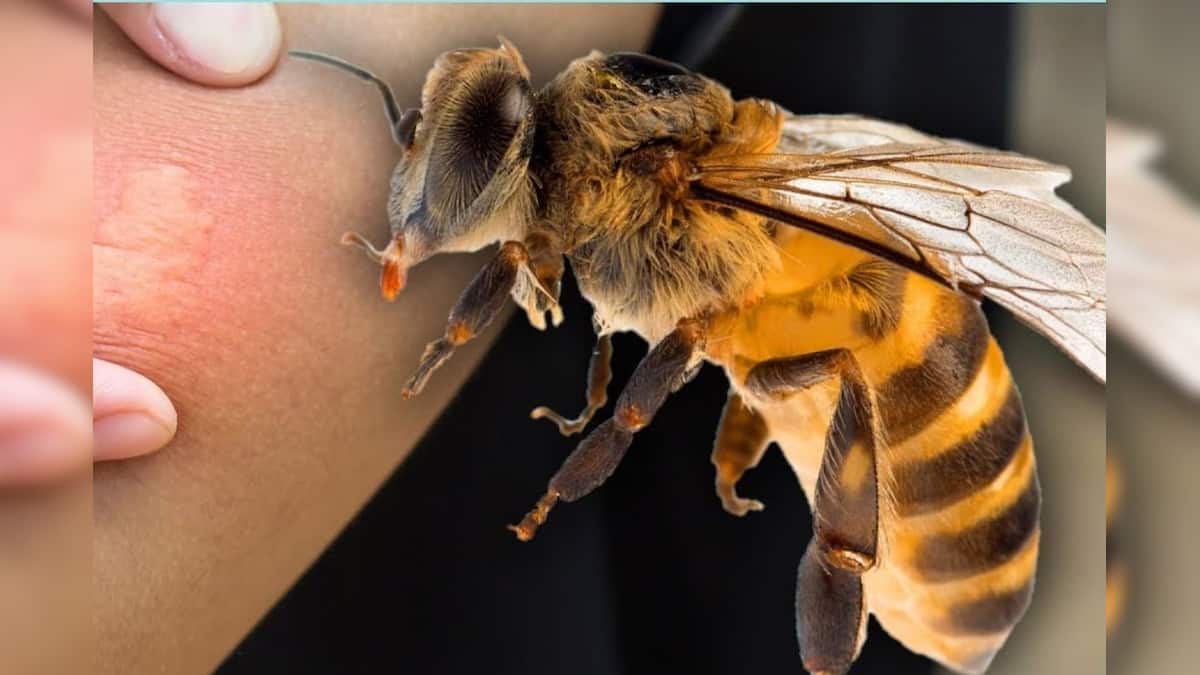 Bee Bite:মৌমাছি কামড়ালে কী করবেন? জ্বালা এবং ফোলা কমাতে দুর্দান্ত ...