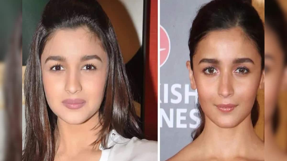 Alia Bhatt Botox: মুখে Botox করাতে গিয়ে ভুল হয়ে গিয়েছে...? আলিয়ার ...