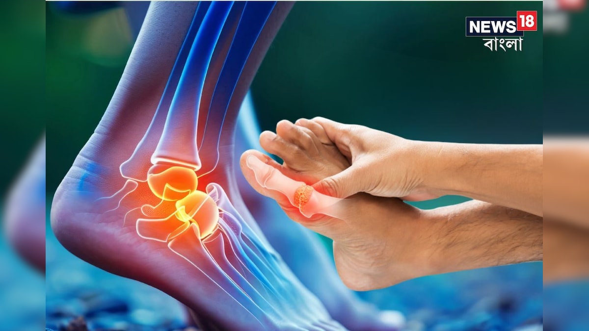 Uric Acid Control Drinks শীত গাঁটে গাঁটে অসহ্য যন্ত্রণায় মুচড়ে