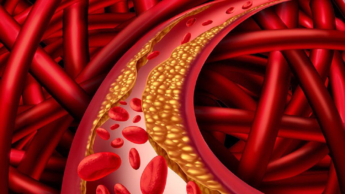 Cholesterol Control Tips: রোজ সকালে খালি পেটে এক কোয়া! হুরহুর করে ...