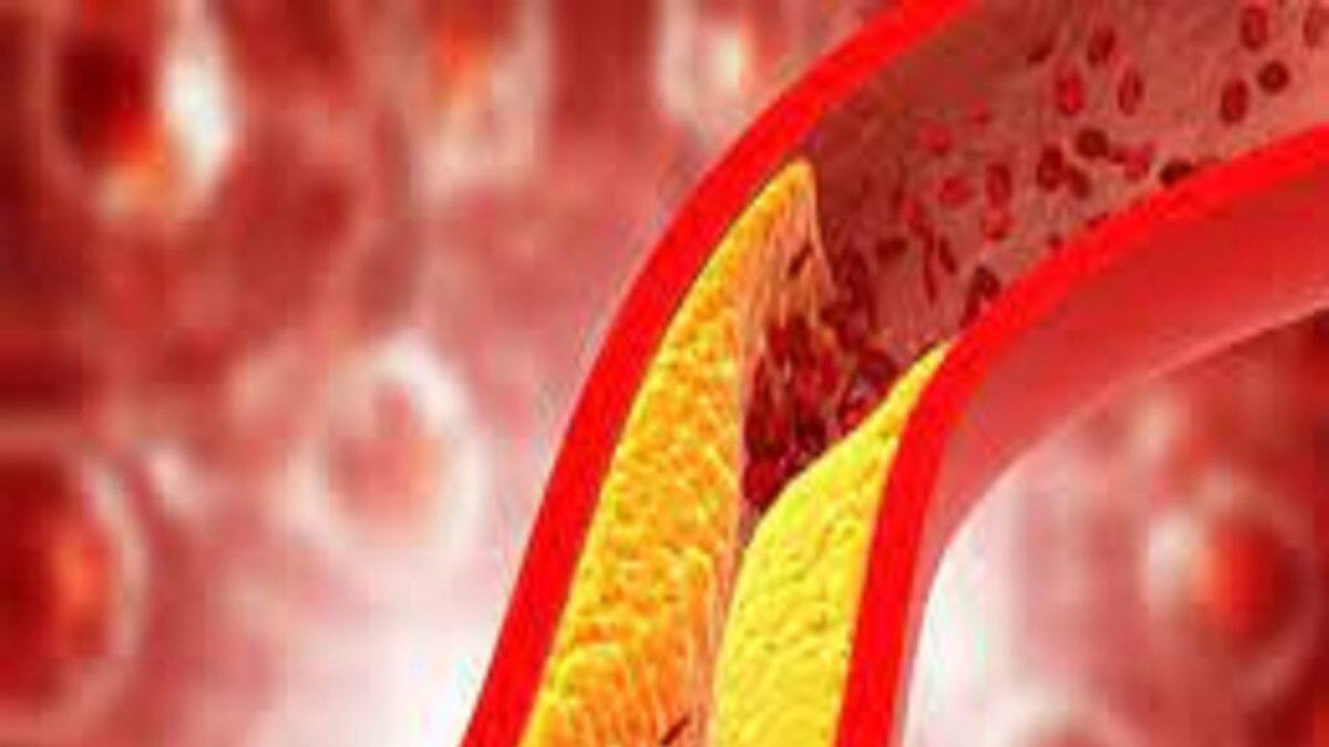 Cholesterol Control Tips: ঘরে বাইরে আপনার আশেপাশেই রয়েছে গুণধর এই দশ ...